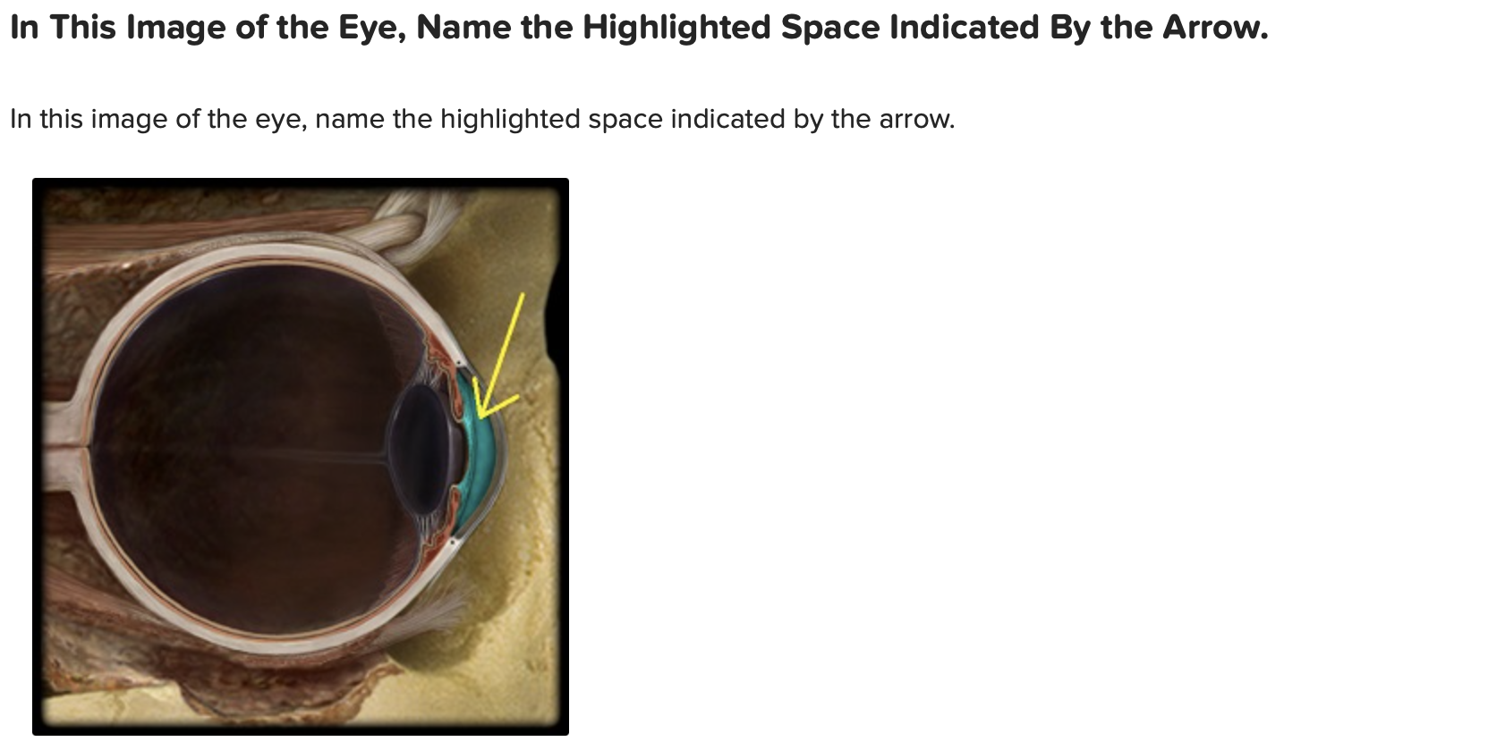 Solved In this image of the eye, name the highlighted space | Chegg.com