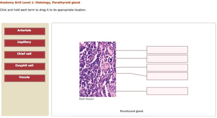 Solved Anatomy Drill Level 1: Histology, Parathyroid gland | Chegg.com