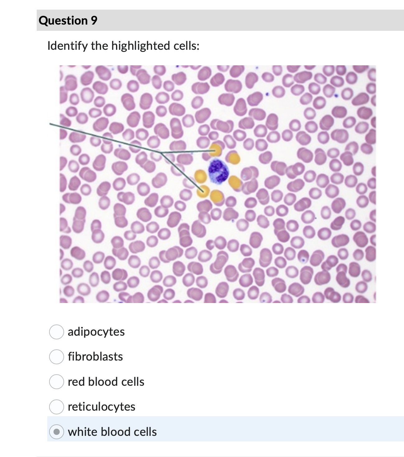 Solved Question 9Identify the highlighted | Chegg.com
