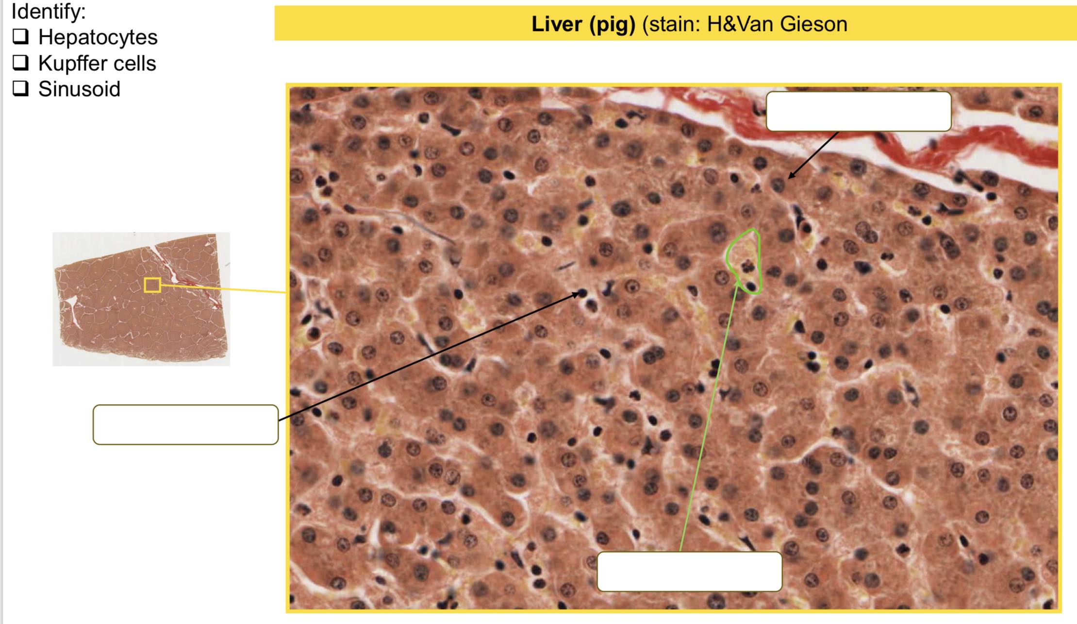 Solved Identify:Identify: Hepatocytes Kupffer cells | Chegg.com