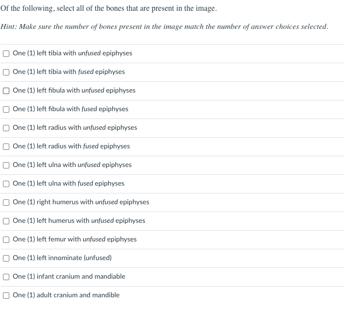 Solved Of the following, select all of the bones that are | Chegg.com