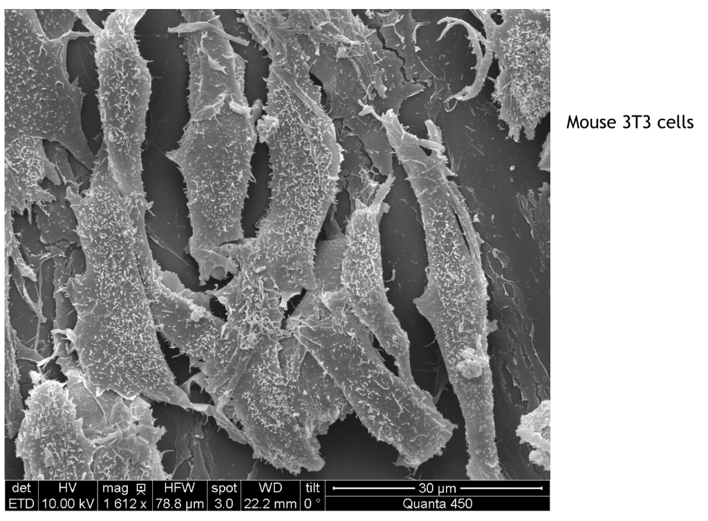 Solved Identify structures in the EM micrographs Match the | Chegg.com