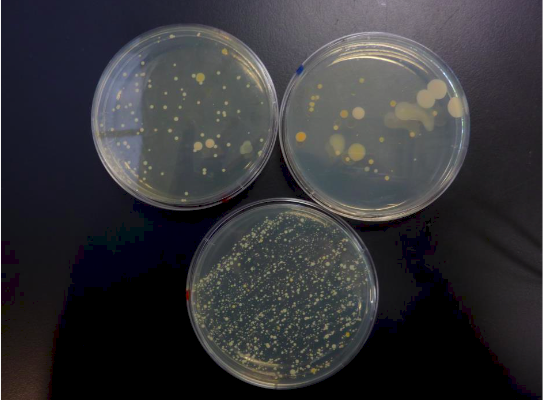 Solved beta-hemolysis Streptococcus pyogenes alpha | Chegg.com