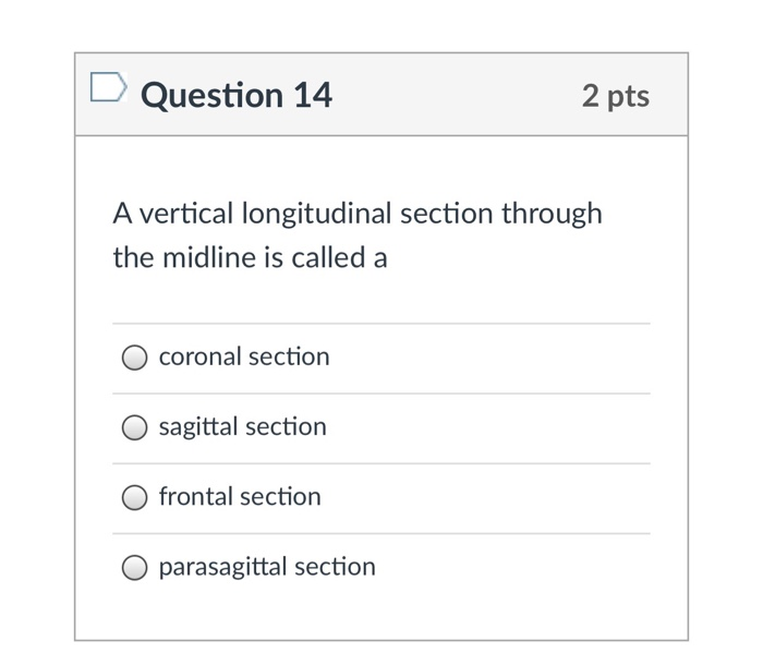 Solved Question 14 2 pts A vertical longitudinal | Chegg.com