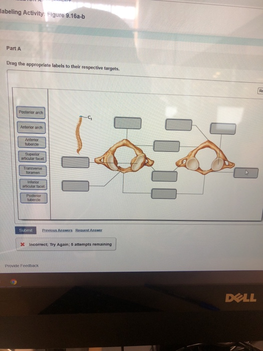 Solved labeling Activity Figure 9.16a-b Part A Drag the | Chegg.com