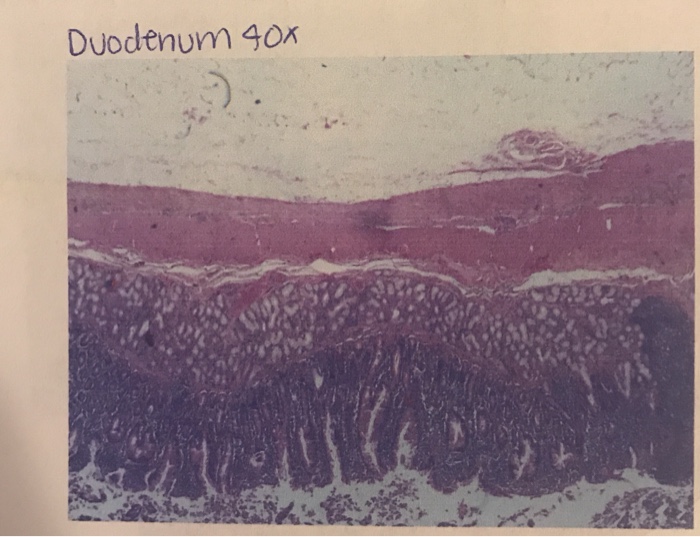 Solved Label histology of Duodenum: lumen, a villus, | Chegg.com
