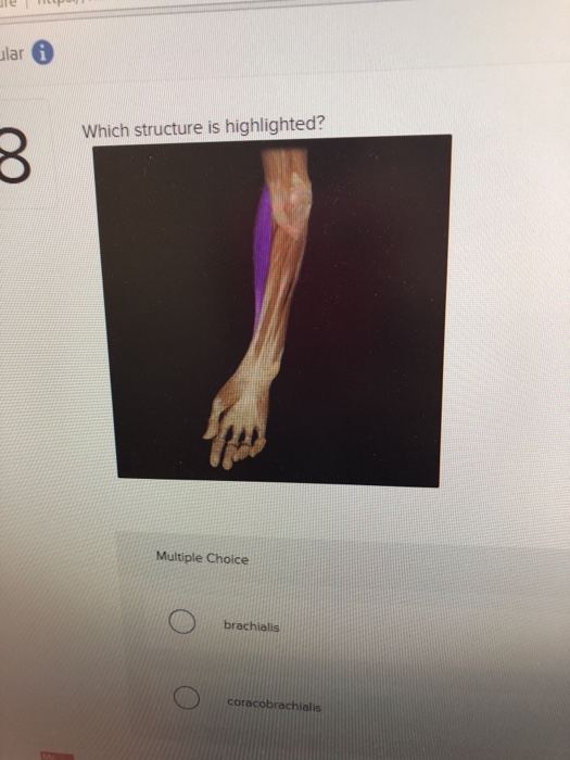 lar Which structure is highlighted? Multiple Choice | Chegg.com