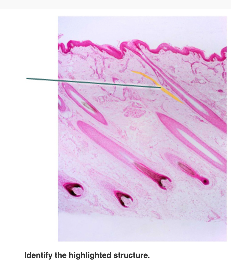 Solved Identify the highlighted structure. | Chegg.com