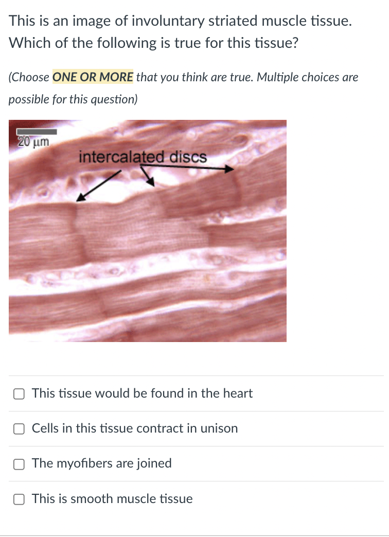 Solved This is an image of involuntary striated muscle | Chegg.com