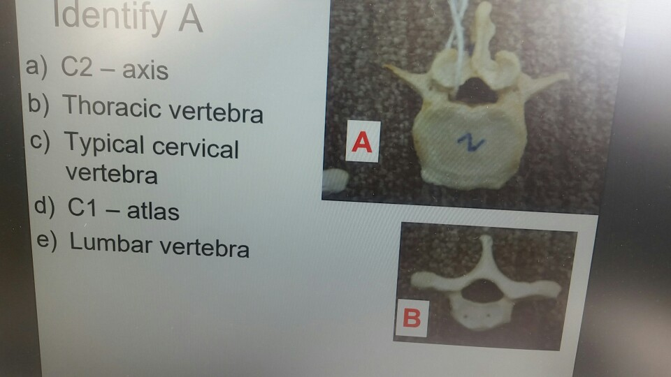 Solved Identify a) C2- axis b) Thoracic vertebra c) | Chegg.com