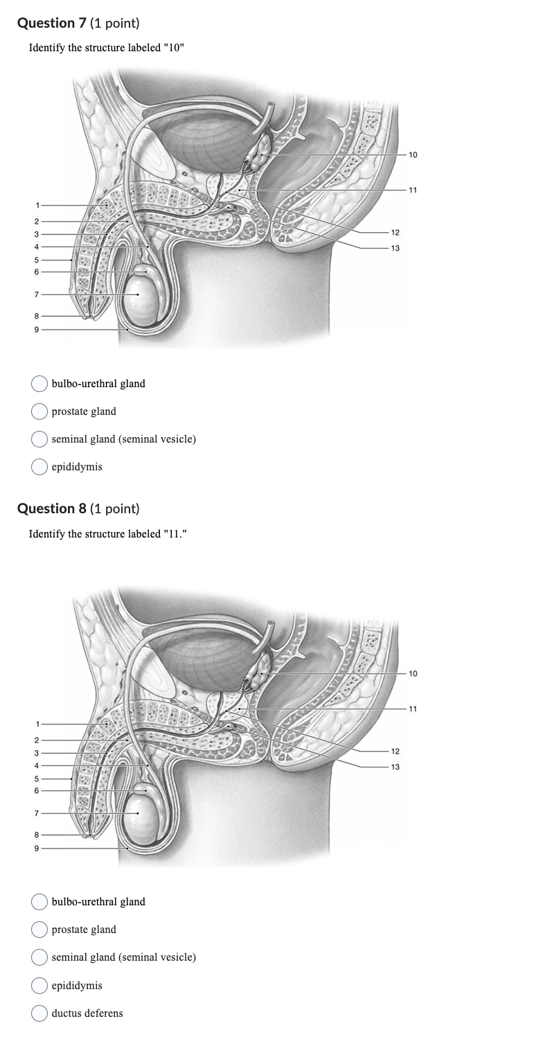 Solved Identify the structure labeled " 10 " bulbo-urethral | Chegg.com