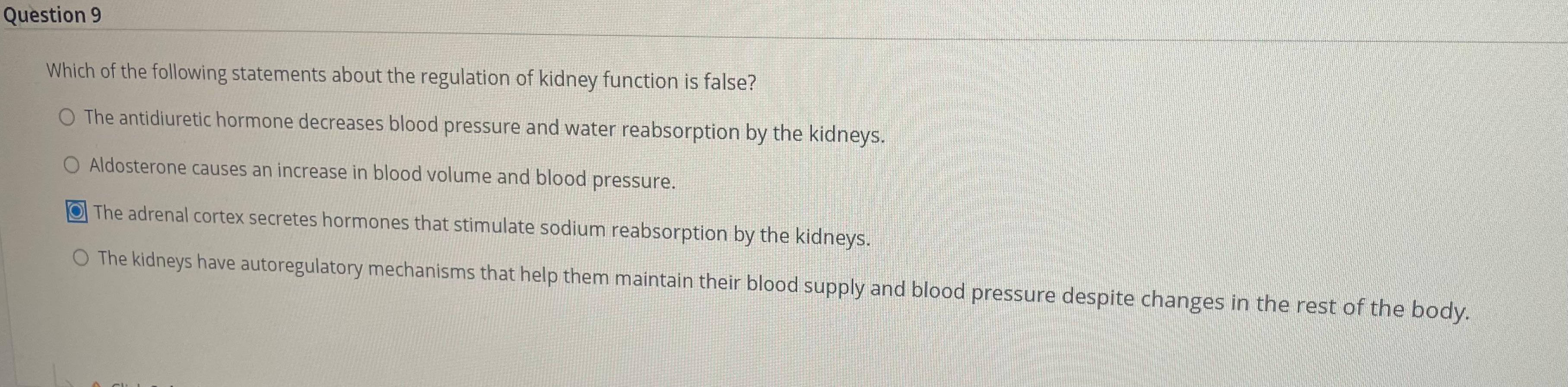 Solved uestion 3 Which of the following statements about | Chegg.com