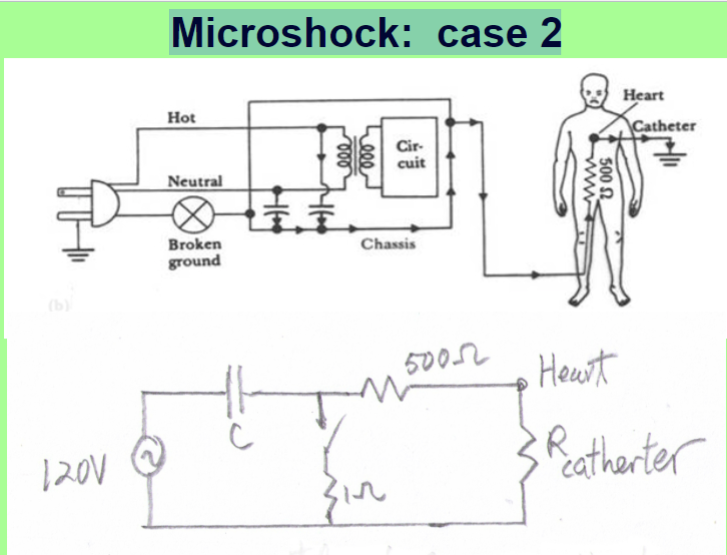A patient received a microshock when using an | Chegg.com