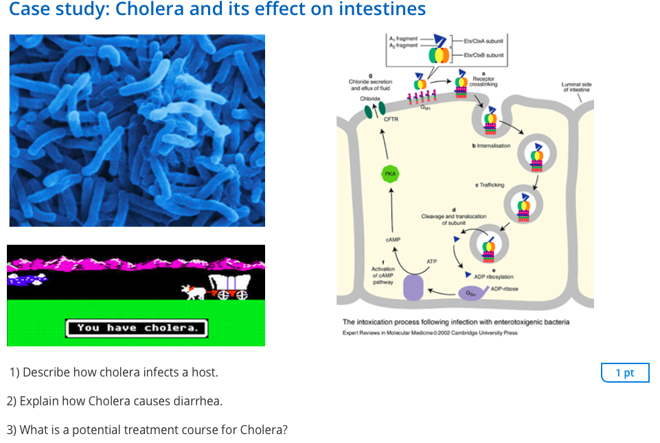 Solved Case study: Cholera and its effect on intestines A | Chegg.com