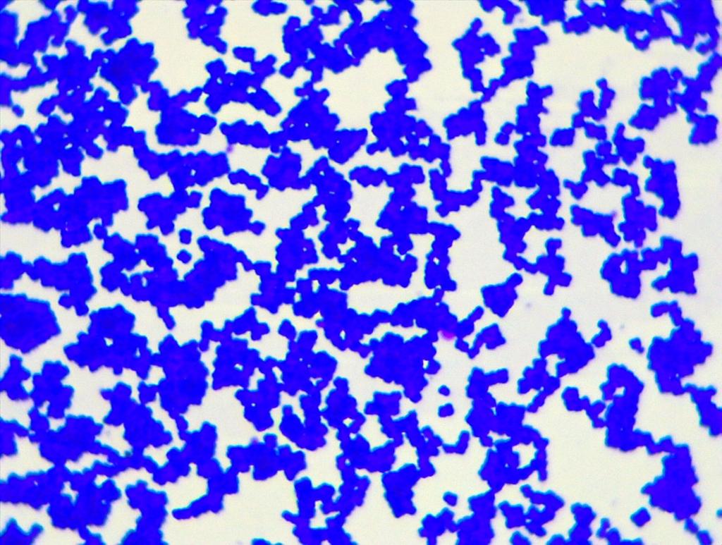 Solved I need to know the name of this bacteria, stained | Chegg.com