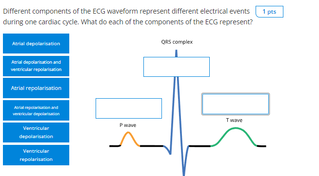 Solved Different components of the ECG waveform represent | Chegg.com