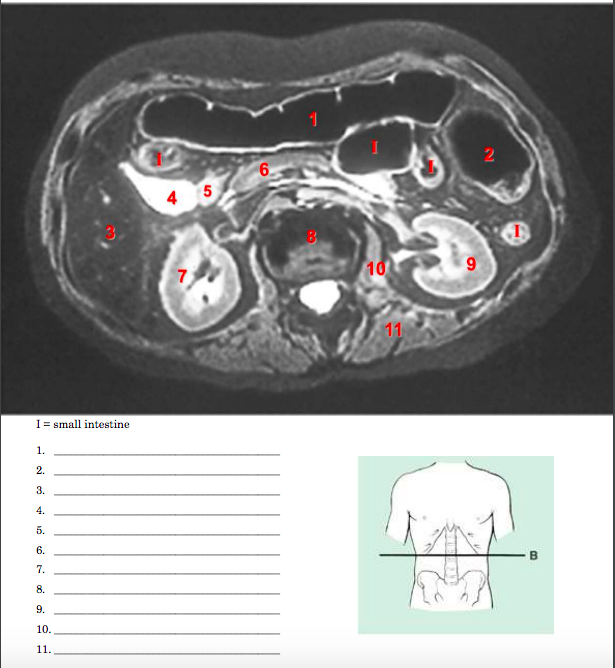 Solved 2 6 5 10 9 11 I = small intestine 1. 2. 3. sti 5. 6. | Chegg.com
