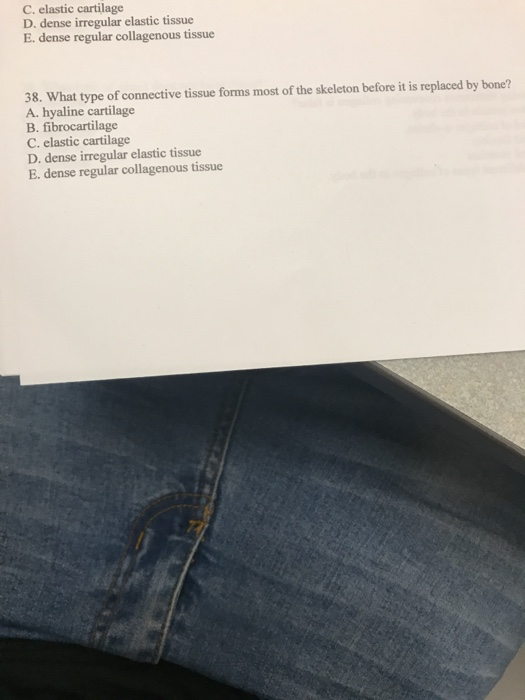 Solved C. elastic cartilage D. dense irregular elastic | Chegg.com