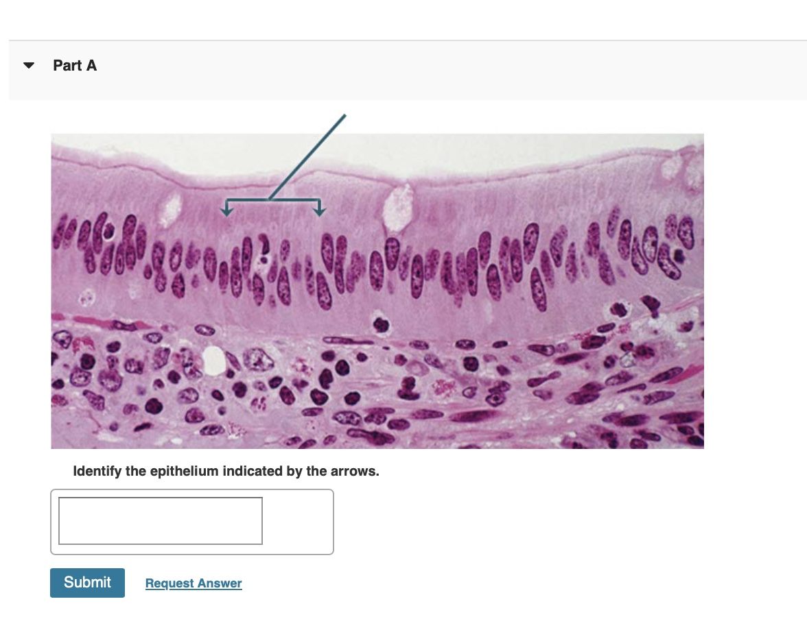 Solved Identify the epithelium indicated by the arrows. | Chegg.com
