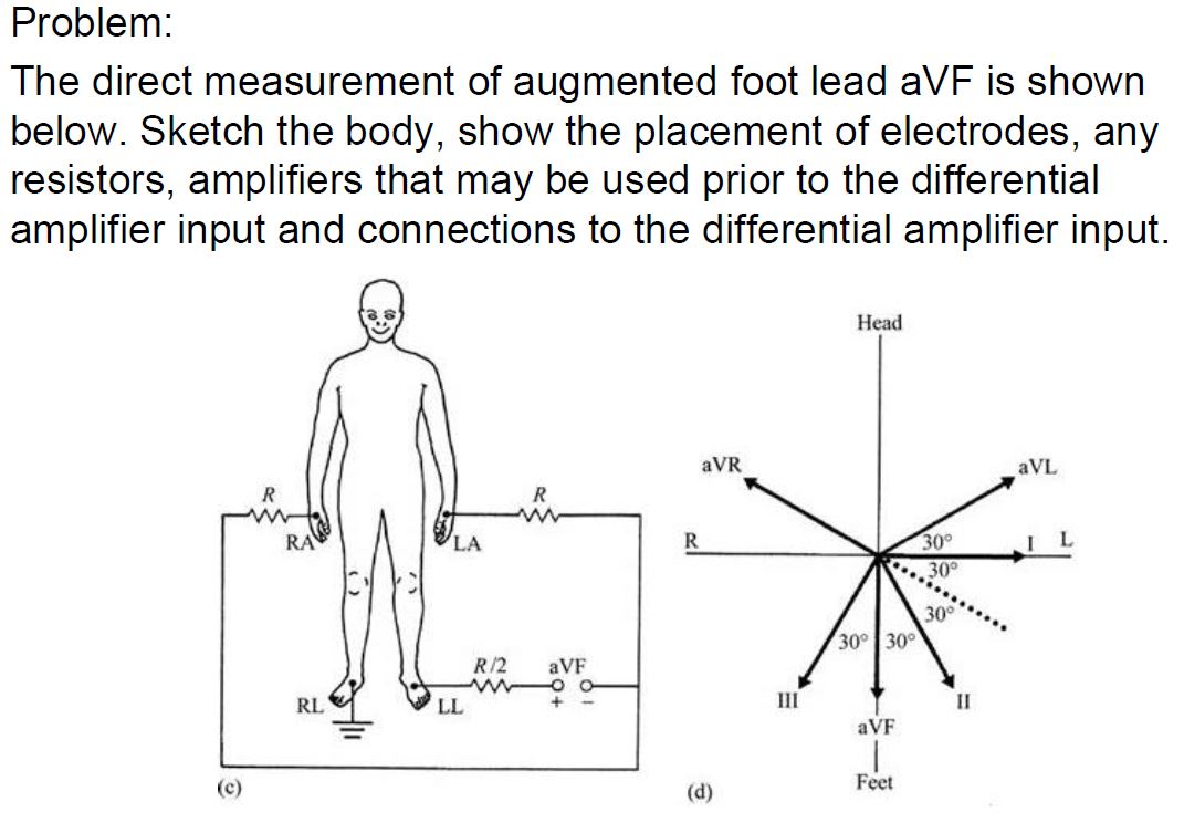 Solved Problem: The direct measurement of augmented foot | Chegg.com