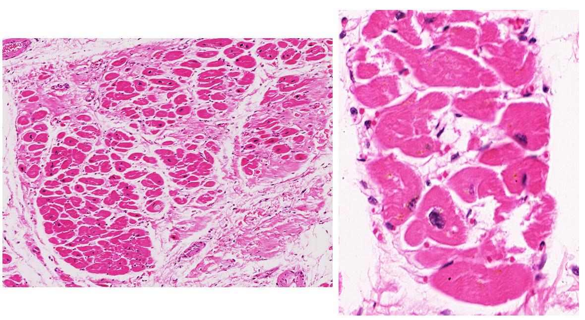 Smooth Muscle Tissue Cross Section