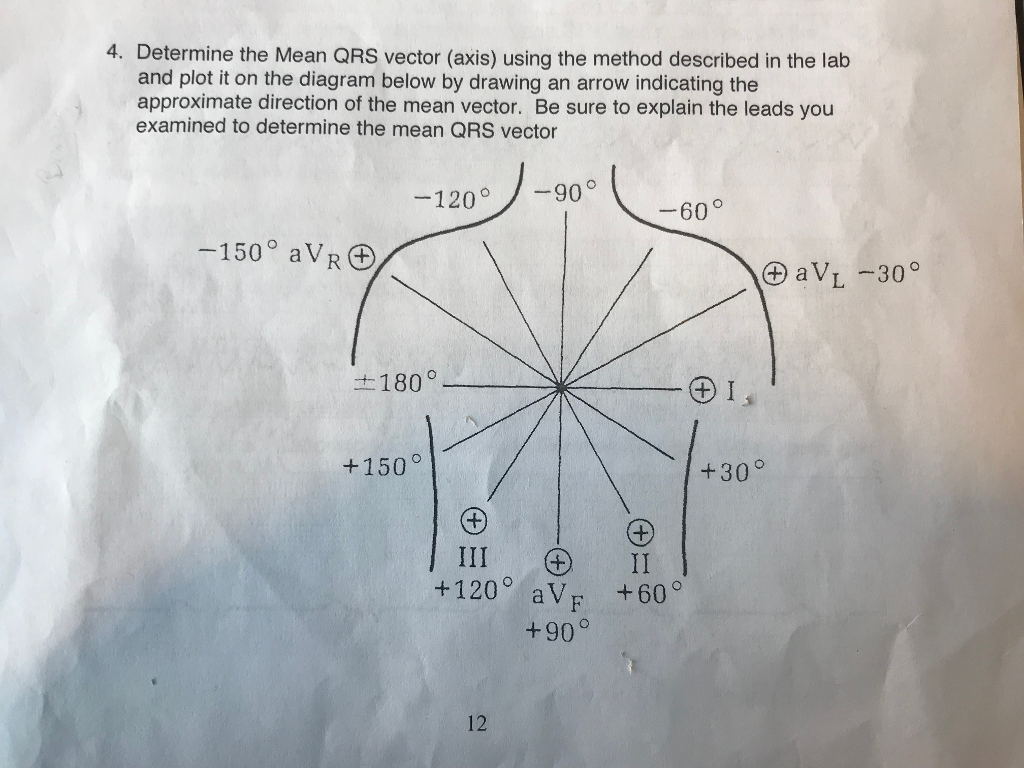 4. Determine the Mean QRS vector (axis) using the | Chegg.com