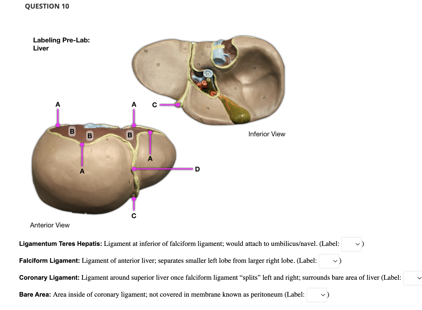 Solved Labeling Pre-Lab: Large Intestine J Anterior View | Chegg.com