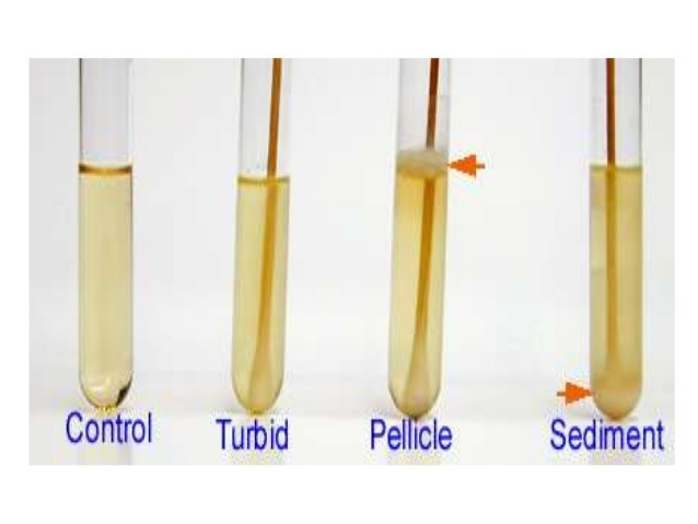 Solved These are the following growth of microorganisms in | Chegg.com