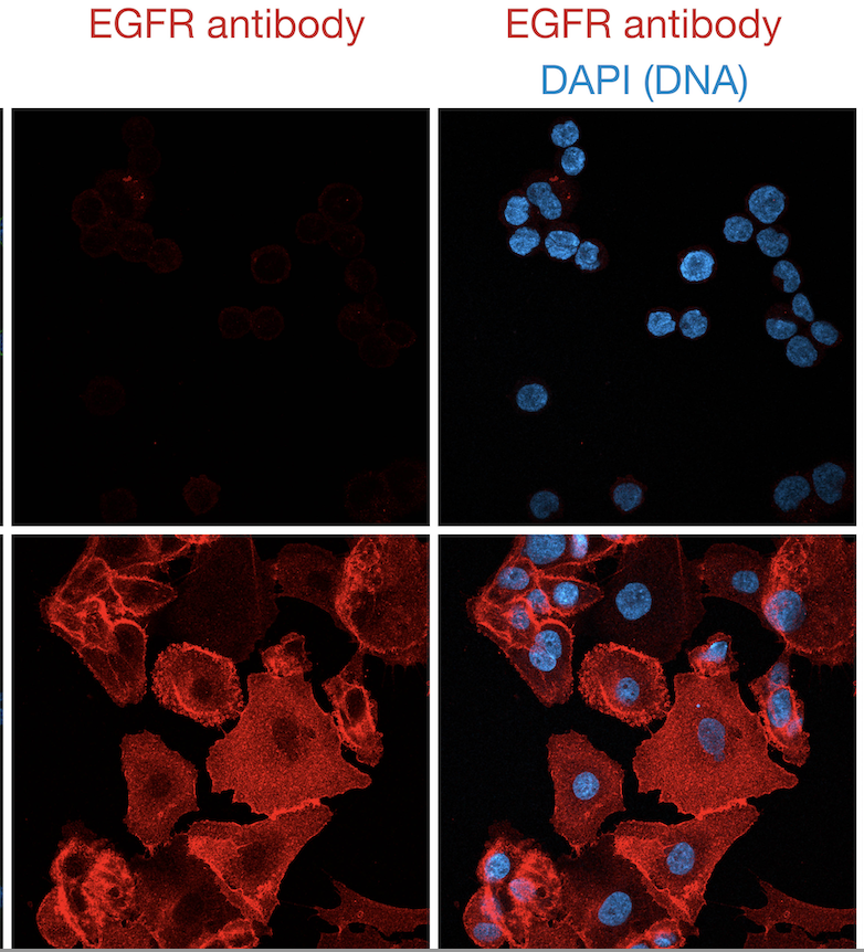 EGFR Status Describe the outcomes of the | Chegg.com