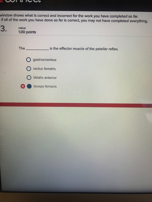 Solved Place the components of the reflex arc in the correct | Chegg.com
