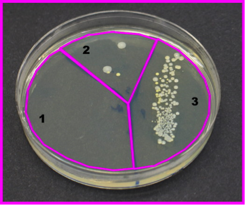 Solved Here is a nutritious agar plate that was inoculated | Chegg.com