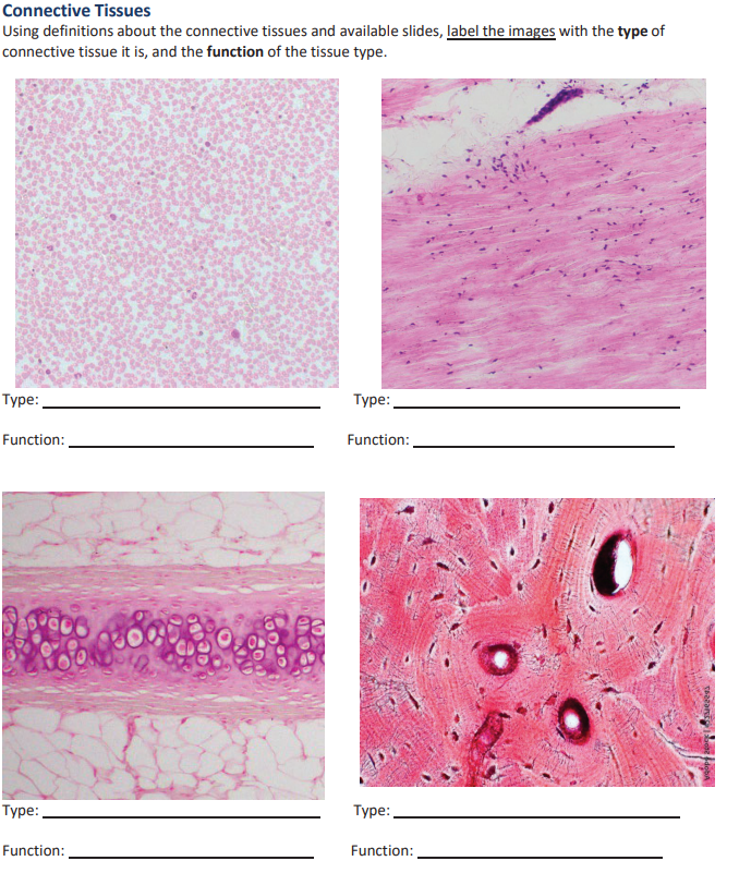 Solved Label the images with the type of connective tissue | Chegg.com