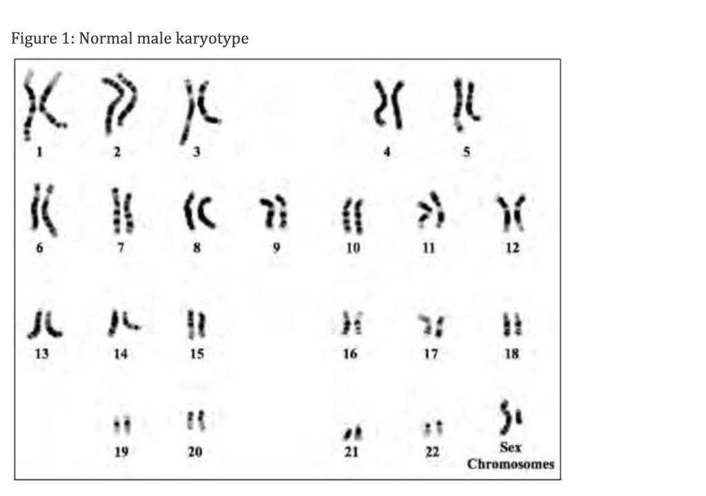Solved Figure 1: Normal male karyotype K> >> X 8 10 11 12 1: | Chegg.com