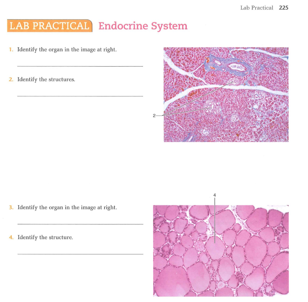 Solved Lab Practical 225 LAB PRACTICAL Endocrine System 1. | Chegg.com