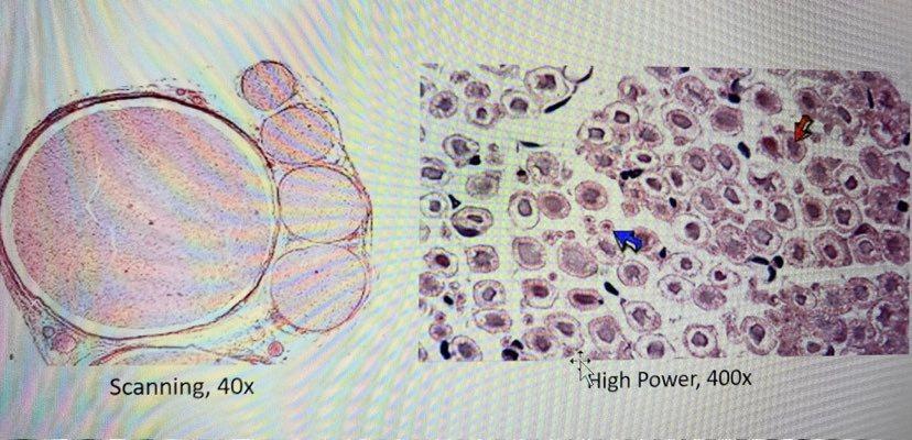 Solved Observe the cross-sectional view of a peripheral | Chegg.com