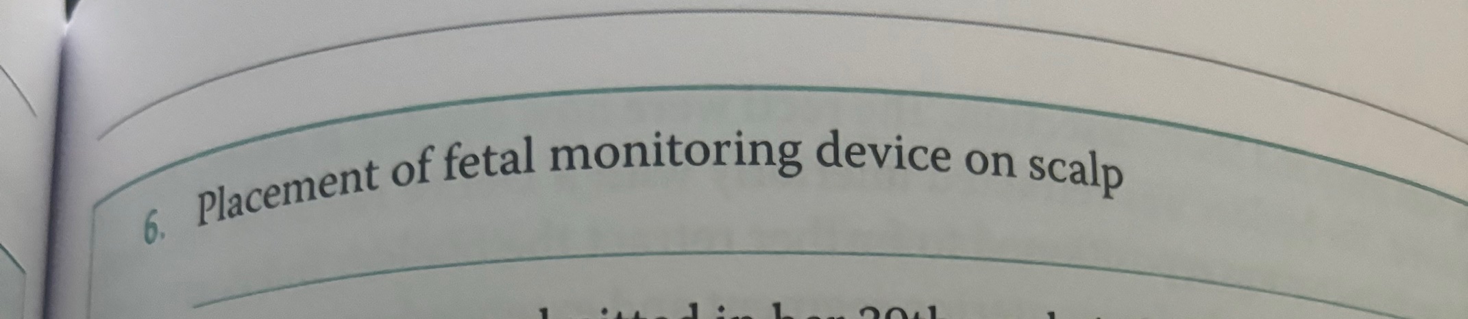 Solved Assign ICD-10-PCS codess to the procedure statement | Chegg.com