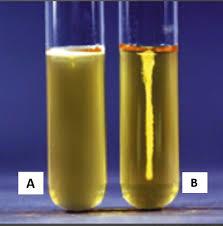 Solved You perform several tests on an unidentified | Chegg.com