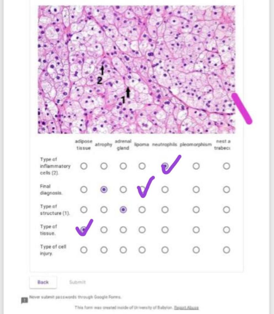 Solved adipose atrophy tissue adrenal nesta poma neutrophis | Chegg.com