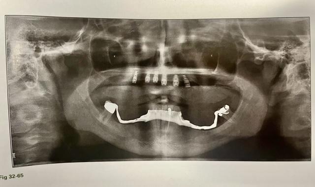 Solved Identify at least six different types of restorative | Chegg.com