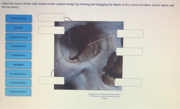 Solved: Label The Bones Of The Orbit Shown In This Cadaver... | Chegg.com