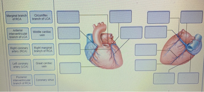 Solved Marginal branch Circumflex of RCA branch of LCA | Chegg.com