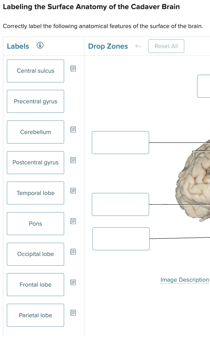 Solved Labeling the Surface Anatomy of the Cadaver | Chegg.com
