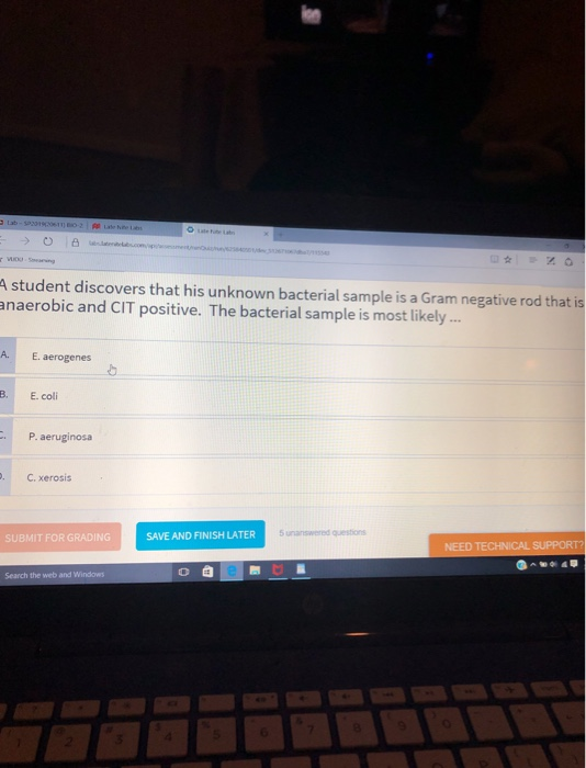 Solved A student discovers that her unknown bacterial sample | Chegg.com