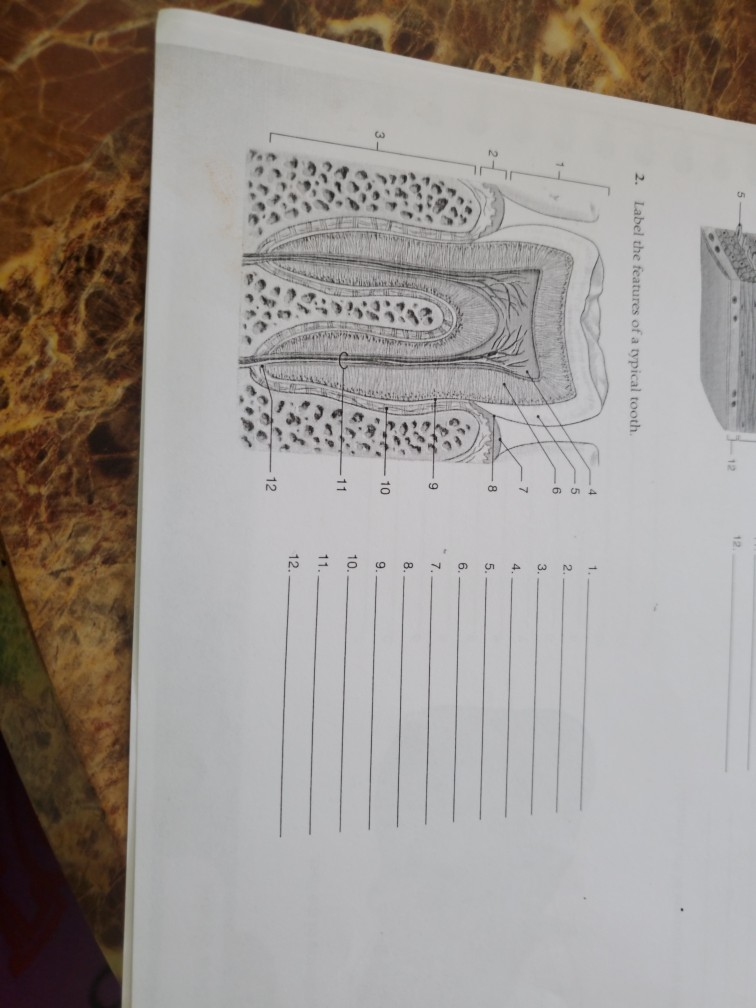 Solved 12 Label the features of a typical tooth. 2. 10 10 3 | Chegg.com