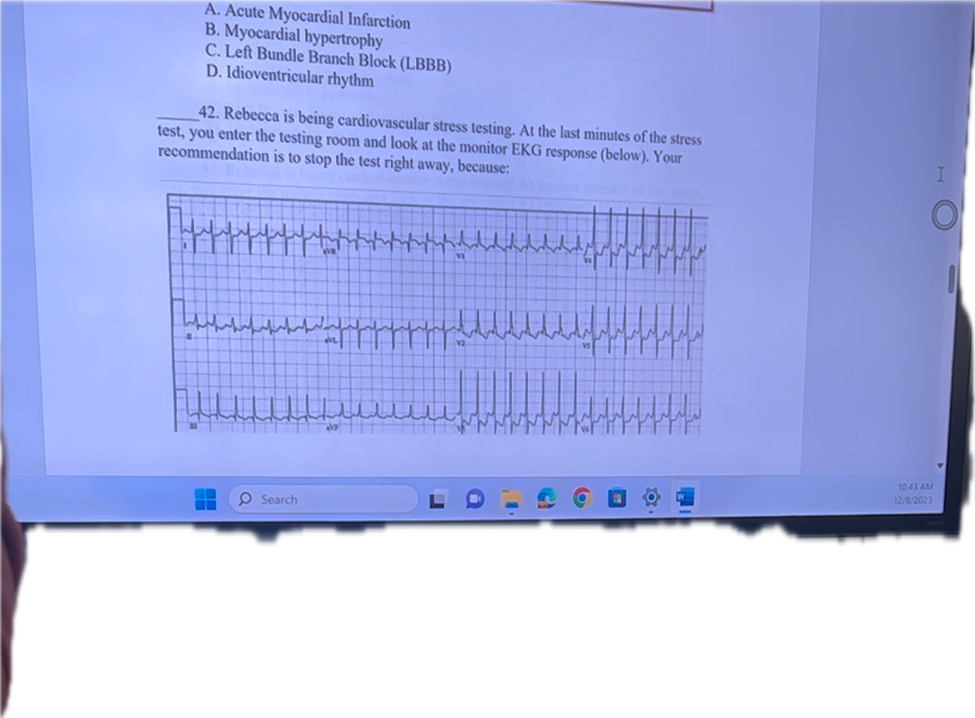 Solved Cardio Review 1. Cardiac cycle runs in systole and | Chegg.com