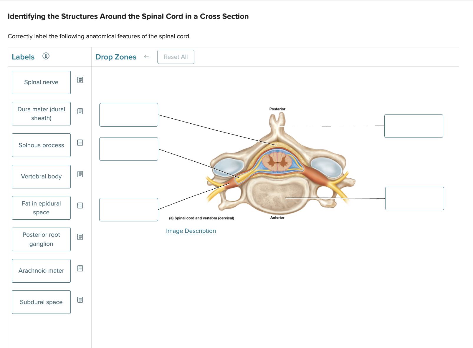 Solved Identifying the Structures Around the Spinal Cord in | Chegg.com