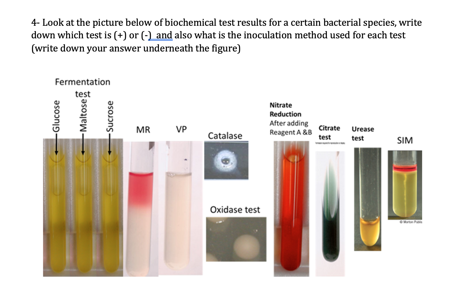 Solved 4- Look at the picture below of biochemical test | Chegg.com