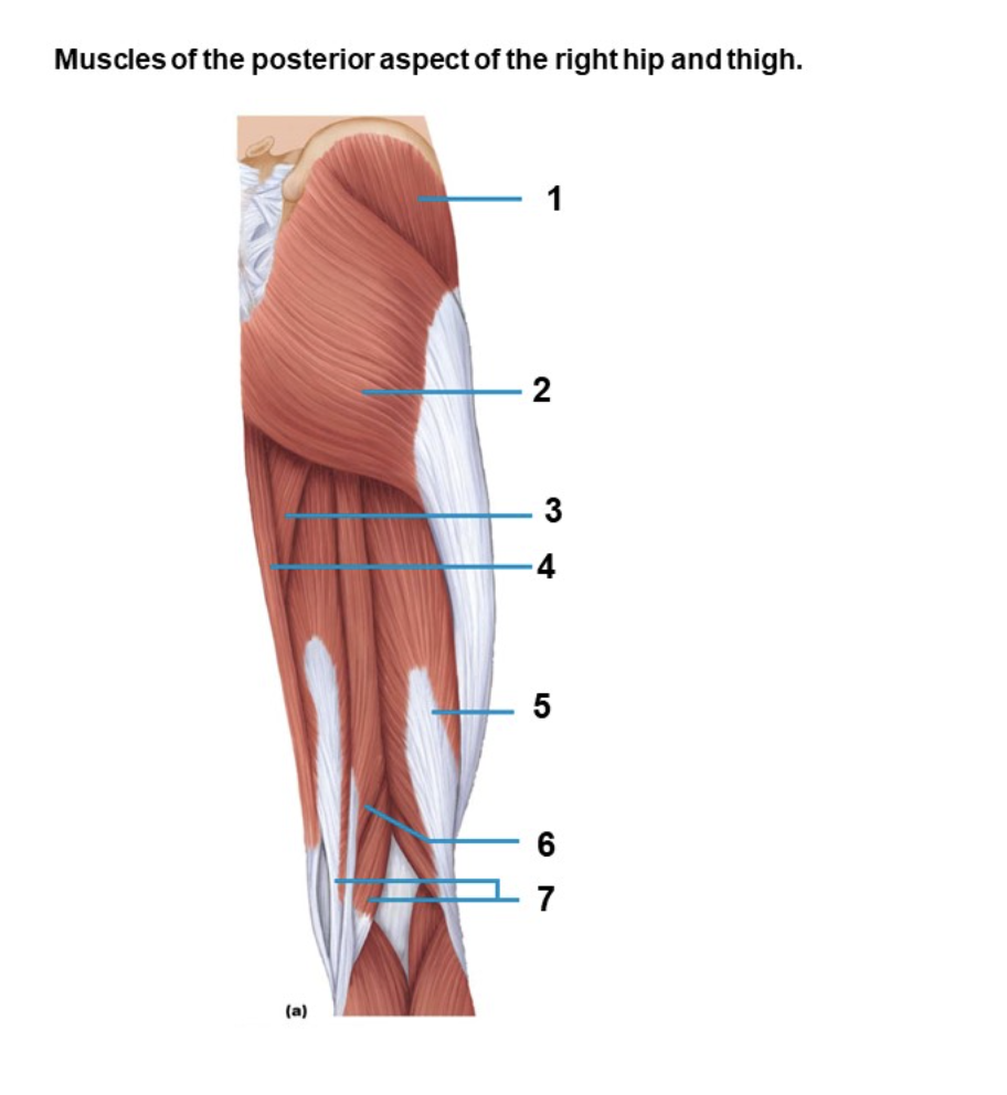 Solved ID all the highlighted muscles Part 1 Section | Chegg.com