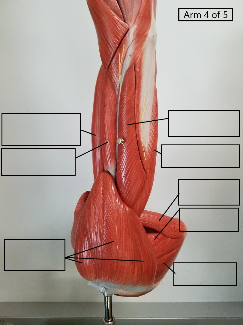 Solved Arm 1 of 5 LS113 Arm 2 of 5] Arm 3 of 5 Arm 4 | Chegg.com