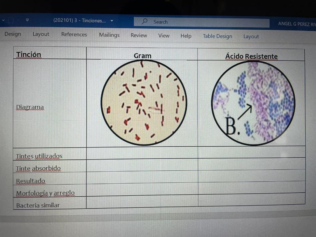 Solved Please help, MICROBIOLOGICAL STAINS • SIMPLE, | Chegg.com